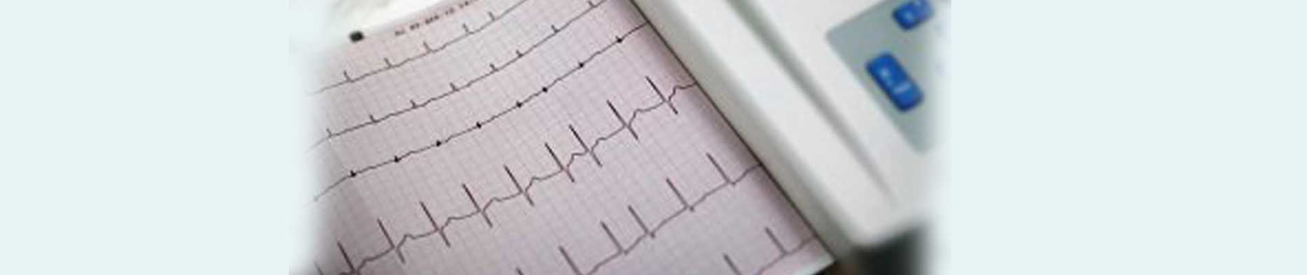 ECG - Zest Diabetes Care